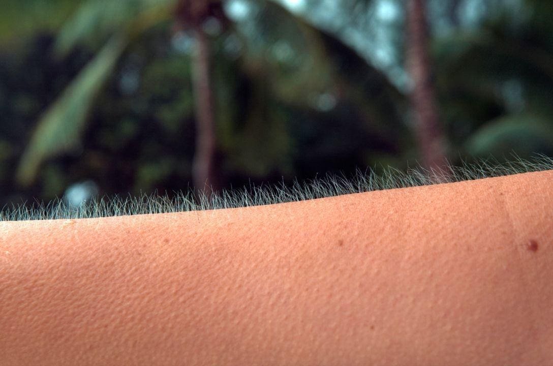 Arrepia ouvindo música? Seu cérebro pode ser especial